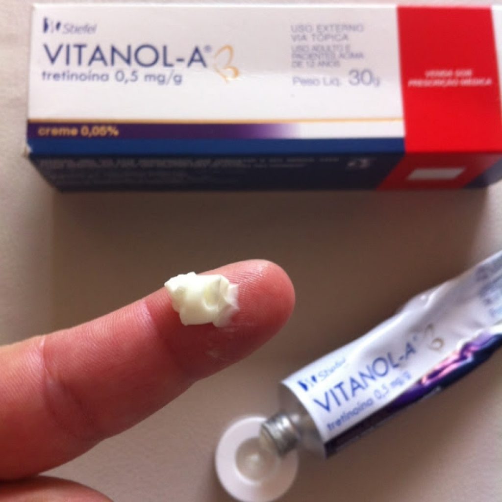Vitanol A é bom para estrias? Saiba tudo aqui!
